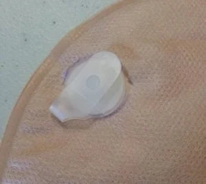 How to Burp an Ostomy Bag (w/ video) | VeganOstomy