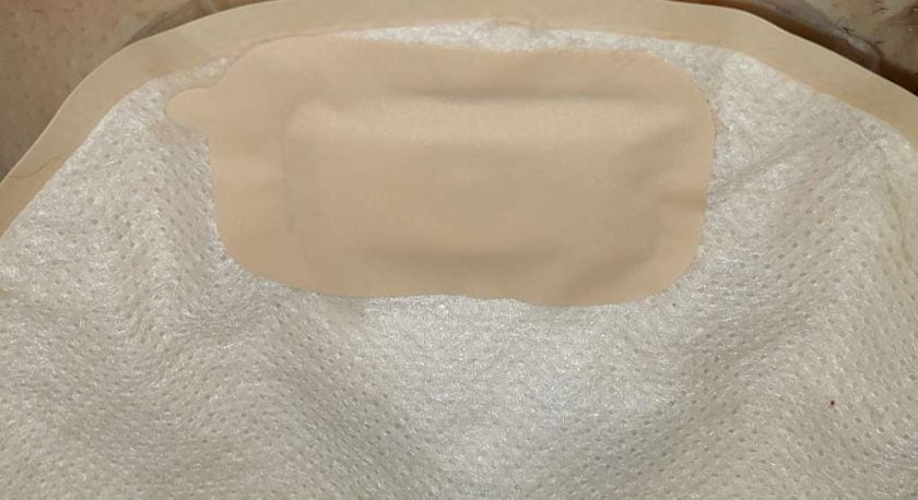 A Practical Guide to Ostomy Filter Stickers (w/ video) | VeganOstomy