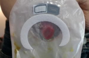 Ostomy Accessories Guide: Stoma Guards | VeganOstomy