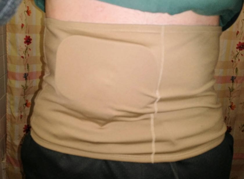 Stoma Protector : REVIEW | VeganOstomy
