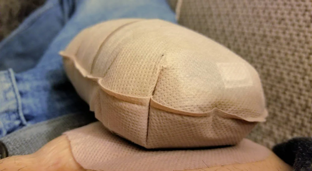 How to Burp an Ostomy Bag (w/ video) | VeganOstomy