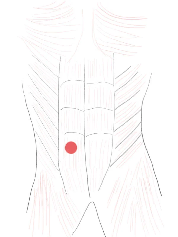 The Importance of Stoma Site Marking (w/ video) | VeganOstomy